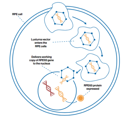 BREAKING NEWS. Luxturna, prima terapie genică aprobată în UE pentru ...