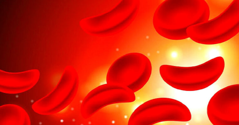 #EHA2020. Adulții cu anemie falciformă au risc crescut de evoluție ...