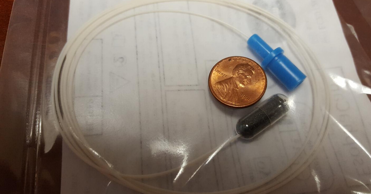 STUDIU. EsophaCap, posibil prima metodă cost-eficientă de screening ...