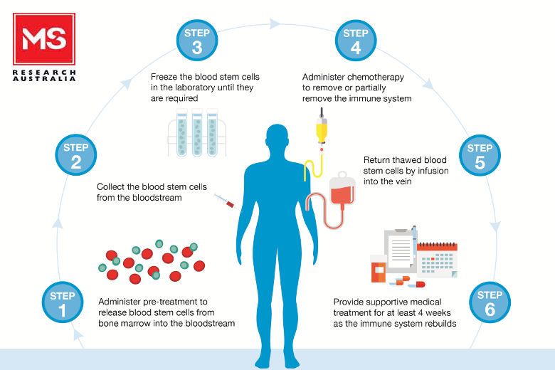 Auto-transplantul de celule stem hematopoietice este mai eficient decât ...