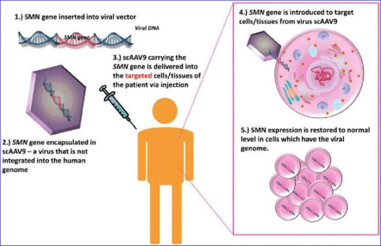 FDA a aprobat Zolgensma, prima terapie genică pentru atrofia musculară ...