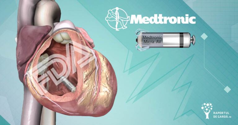FDA aprobă Micra AV, primul stimulator cardiac fără fire sau electrozi ...