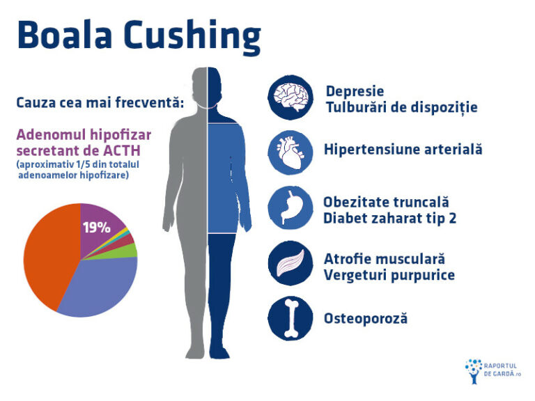 Osilodrostat, prima terapie orală care blochează sinteza cortizolului ...