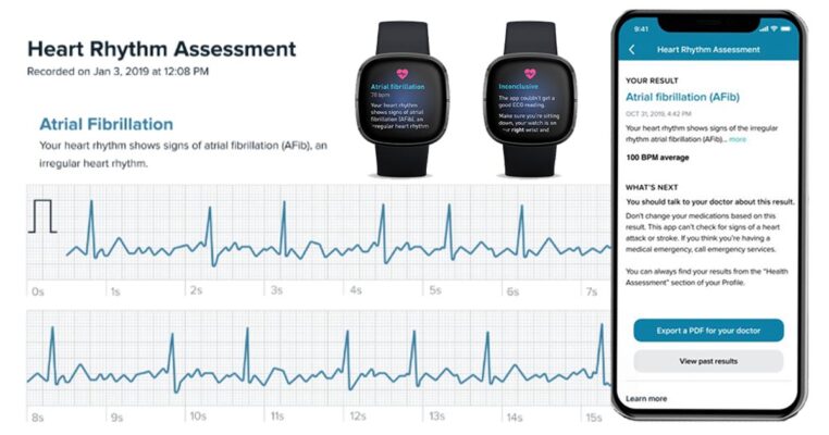 FDA aprobă Fitbit ECG, aplicație mobilă utilizată pentru monitorizarea ...
