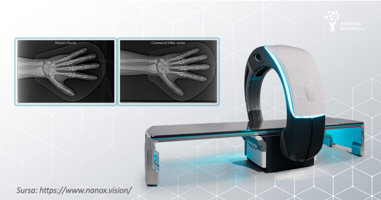 FDA autorizează Nanox.ARC, un sistem inovator de radiologie cu sursă ...