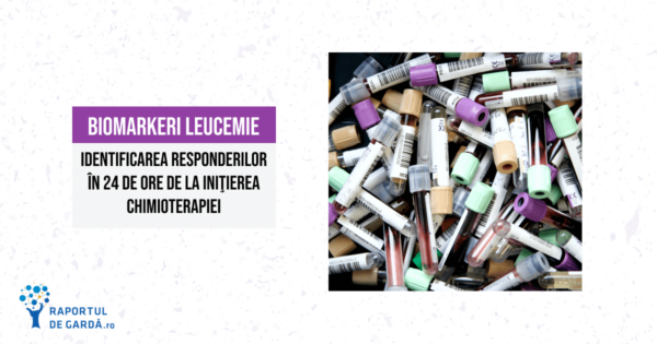 Supraviețuirea pacienților cu leucemie acută, estimată chiar din prima ...